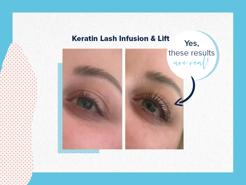 MedSpa Specials San Juan Capistrano | Botox Specials Laguna Niguel